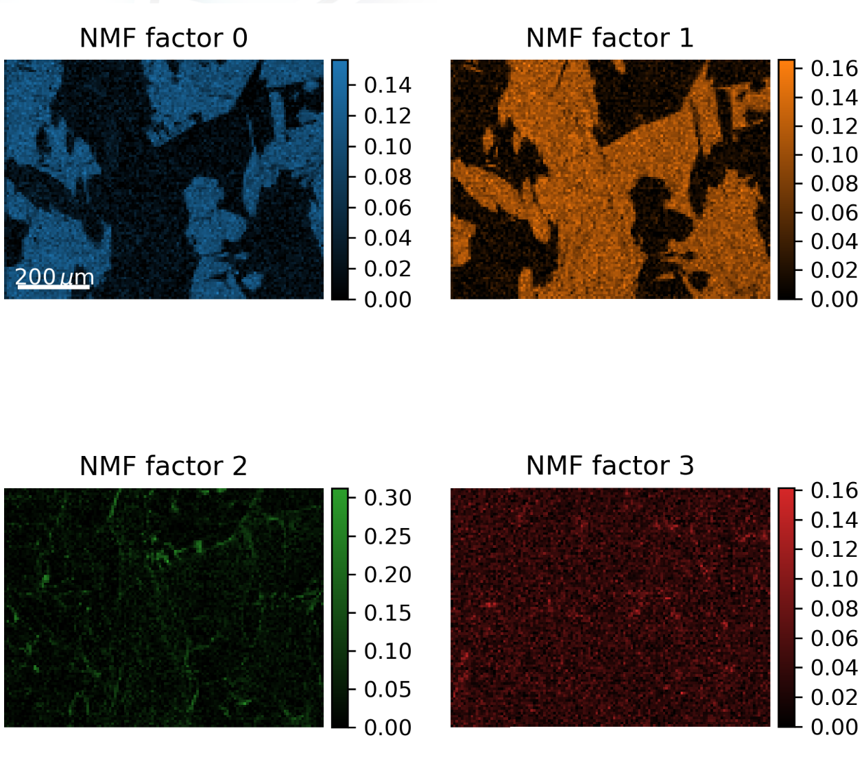 Electron Microscopy in the Age of “Big Data”